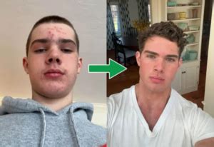 Clavicular Incel Wiki