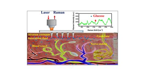 Surface Enhanced Raman Spectroscopy Based Biosensor With A Microneedle Array For Minimally