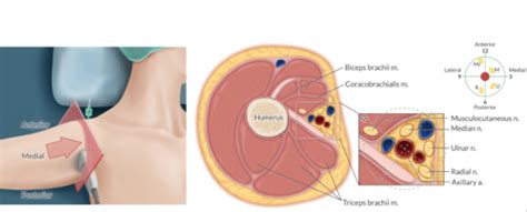 Upper Extremity Blocks Flashcards Quizlet Upper Extremity Blocks Flashcards Quizlet