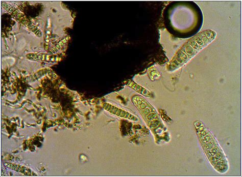 Lichen Graphis Scripta