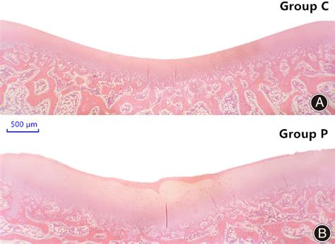 Microscopic View Of Femoral Trochlear Groove In The Two Groups 3 Months Download Scientific