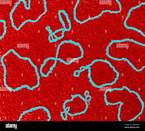 Dna Plasmids Coloured Transmission Electron Micrograph Of Dna Plasmids