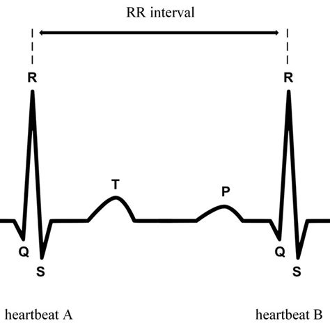 Pdf Fusing Transformer Model With Temporal Features For Ecg Heartbeat