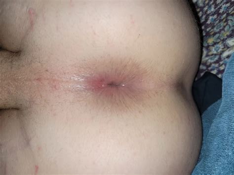 My Tight Ginger Cum Dump Hole 32 Nude Pics Xhamster