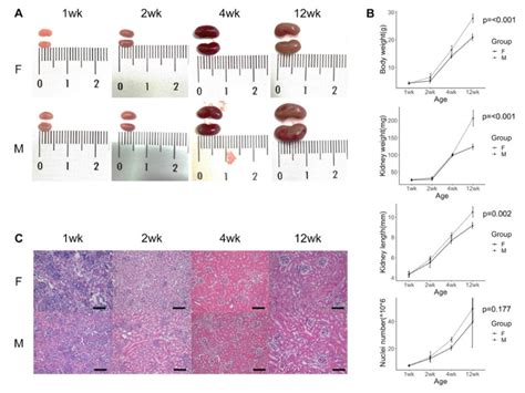 Sex Specific Proximal Tubular Cell Differentiation Pathways Identified