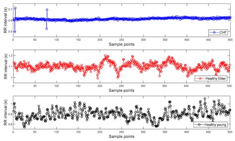 Multiscale Distribution Entropy Analysis Of Short Term Heart Rate Variability