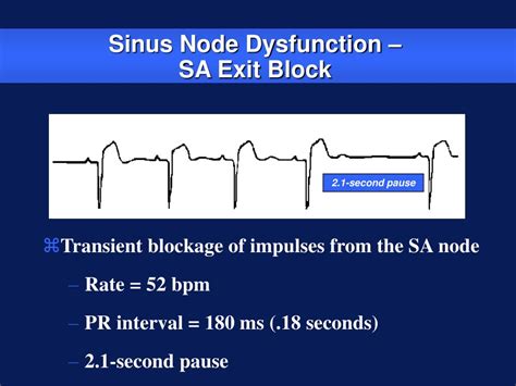 Ppt Indications And Mode Selection Part I Powerpoint Presentation