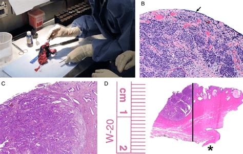 Inking The Anterior And Posterior Uterine Serosal Surfaces With Download Scientific Diagram