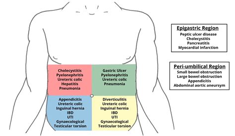 Abdominal Pain Pathogenesis Diagnosis What Diseases May Indicate