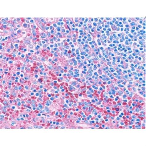 Liquid Reagent Giemsa Stain Kit At ₹ 13216kit In Hyderabad Id 22930778430