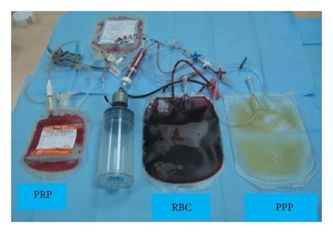Biosafe Sepax System A Autologous Prp And Plasma To Prepare Platelet