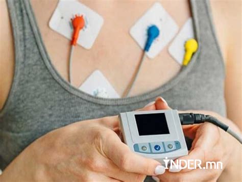 Артерийн даралт 24 цагийн хяналт зүрхний холтер 70 хувийг ЭМД ын сангаас хөнгөлнө