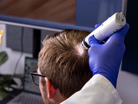 Trichoscopy With Dino Lite Trichoscopes Dino Med