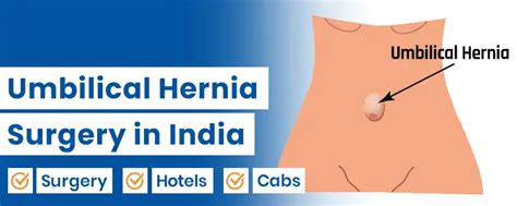 Umbilical Hernia Surgery In India Top Doctors Hospitals And Treatment