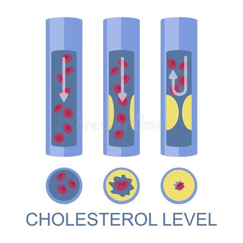 Cholesterol Meter Color Scale With Arrow Vector Isolated Illustration Low Normal And High