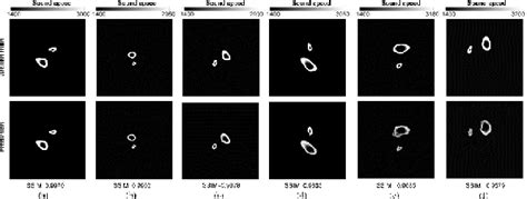 Figure 6 From Deep Learning Based Ultrasound Computed Tomography For Cortical Bone Imaging