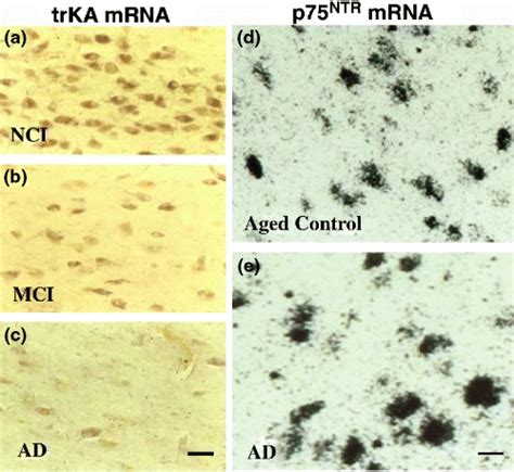 Validation Of Cdna Array Results Using In Situ Hybridization
