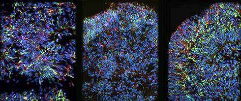 Tsc2 Gene Cortical Thickness Long Noncoding Rna The Transmitter Neuroscience News And