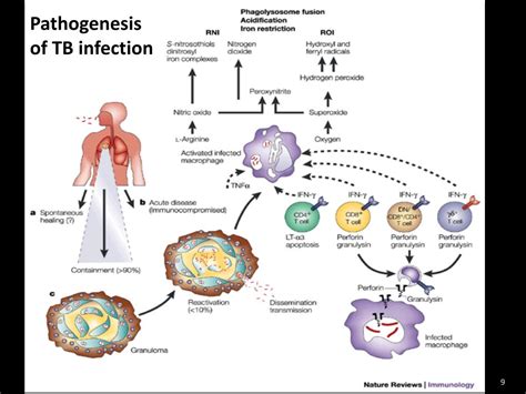 Pulmonary Tuberculosis Pathophysiology Diagram