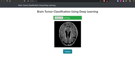 Github Shamanchandini Brain Tumor Detection Using Convolutional Neural Network Major Project
