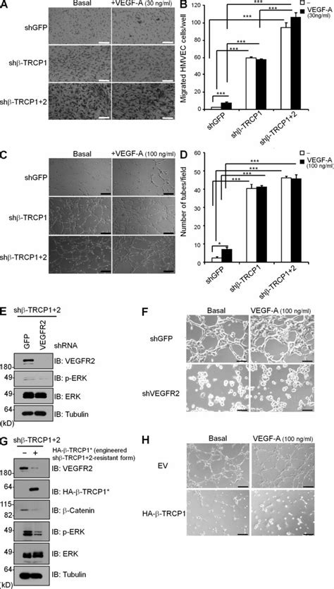 β Trcp Regulates Endothelial Cell Migration And Angiogenesis In Vitro