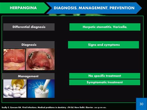 Fungal And Viral Infections Of The Oral Cavity Fungal Infections Viral