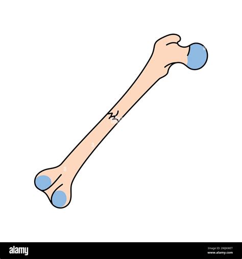 Transverse Bone Fracture Line Icon Vector Isolated Element Editable