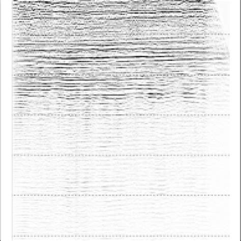 Stacked Output Obtained From The Wiener Filter Approach Download Scientific Diagram