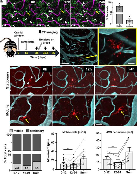 Sex And Interferon Gamma Signaling Regulate Microglia Migration In The