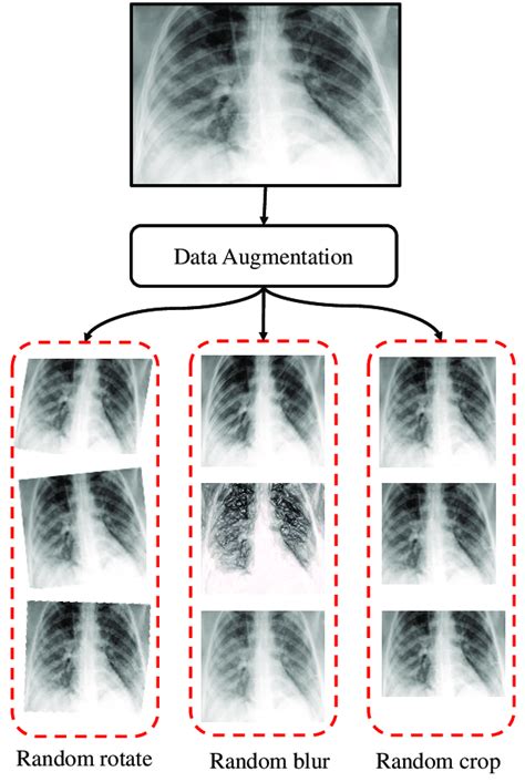 Sample View Of Obtained Results From The Data Augmentation Approach