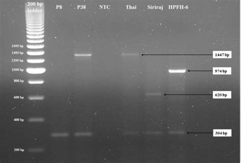 Representative Of Multiplex Gap Pcr Gel Electrophoresis Multiplex