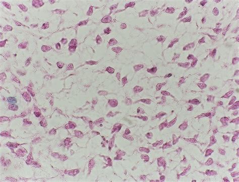 Salisburys Graduate Histology Connective Tissue