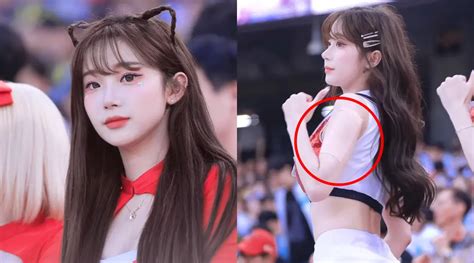 李珠珢的4件事！上場左手必貼膠布原因曝 男友、整形傳聞一次看 日韓 娛樂 Nownews今日新聞