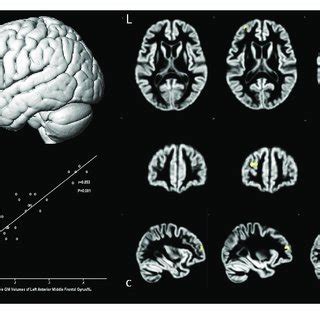 The Cortex Related To Associative Memory And Their Pearson Download Scientific Diagram