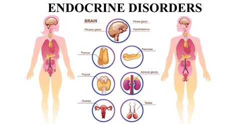 Endocrine Disorders Types Causes And Symptoms
