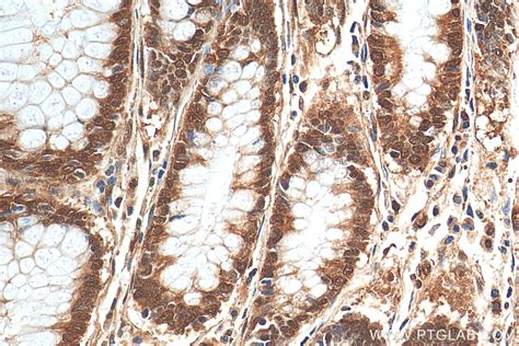 Stat6 Antibody 51073 1 Ap Proteintech