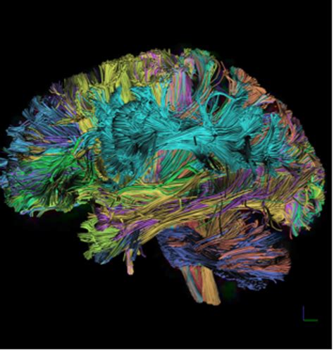 Biomedical Imaging School Of Engineeringschool Of Engineering