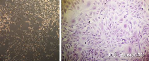 成纤维细胞的形态 知乎