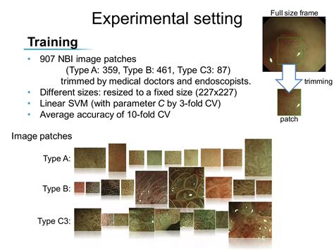 Computer Aided Colorectal Tumor Classification In Nbi Endoscopy Using Cnn Features Fcv2016 Ppt