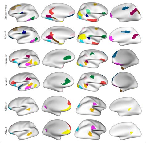 Parcels In Common Between Atlas 5 Parcellation And Some Parcellations Download Scientific