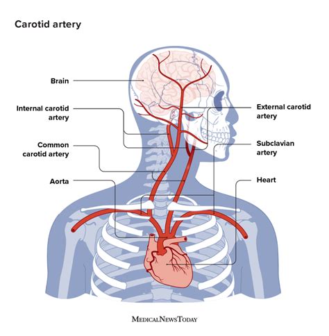 Marfan Syndrome Symptoms And Causes Artofit