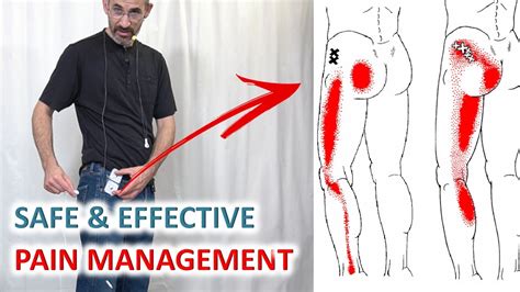 Pain In Top Right Buttock Cheek At Oscar Loveless Blog