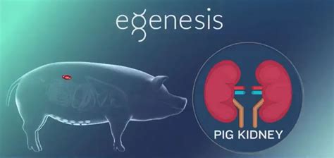 全球首例！等不到人类肾脏的他移植了猪的 果壳 科技有意思