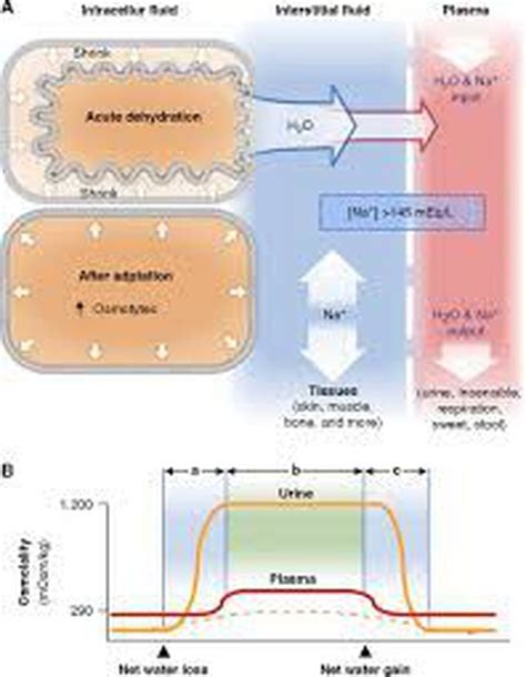 Causes Of Hypernatremia Medizzy