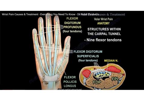 How To Treat Nerve Pain In Wrist At Antonio Christie Blog