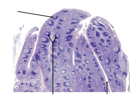 Lymphatic Lab Diagram Quizlet
