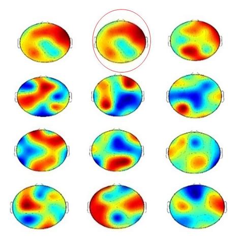 Comparison Of Automatic Artifact Detection Methods Proposed And Extant Download Scientific