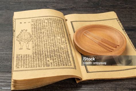 침술은 중국 전통 의학입니다 침술에 대한 스톡 사진 및 기타 이미지 침술 중국 문화 건강관리와 의술 Istock