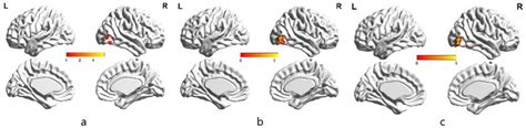 Separate Presentation Of Secure Individuals Attentional Engagement To Download Scientific