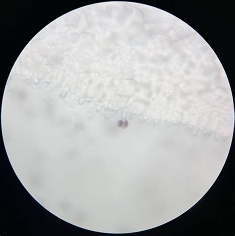 Captured This Photo Of A Basidium With 4 Basidiospores Attached To It On A Mushroom I Found